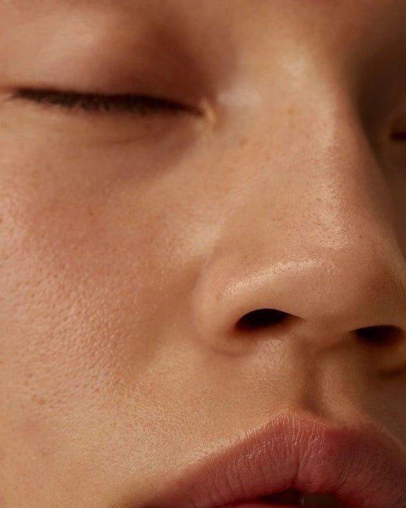Understanding Problem Skin: Sebaceous Filaments – Strange Luxury
